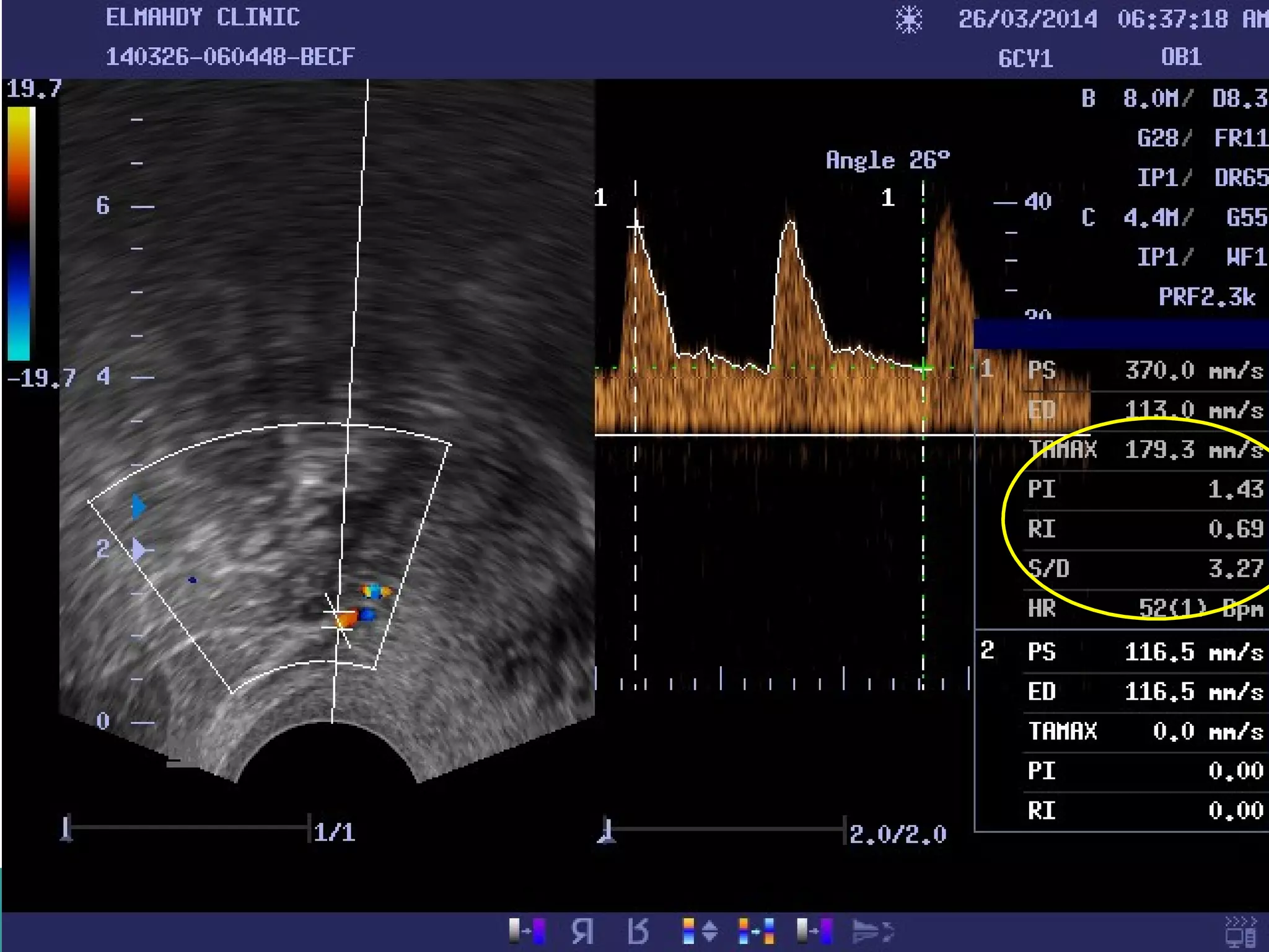 Ovulation induction | PPT