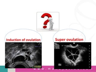 Ovulation induction | PPT