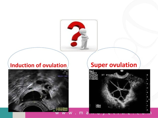 Ovulation induction | PPT