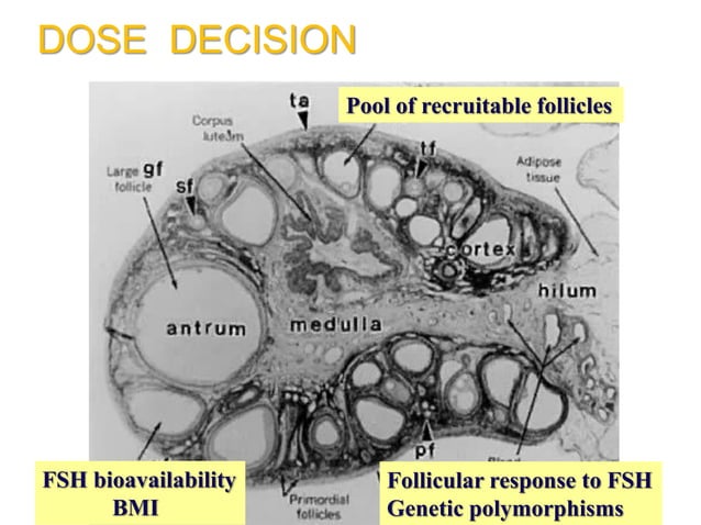 Algorithms For Ovulation Induction Protocols Assisted Reproductive