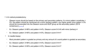 Prostate cancer guidelines 2023 | PPTX