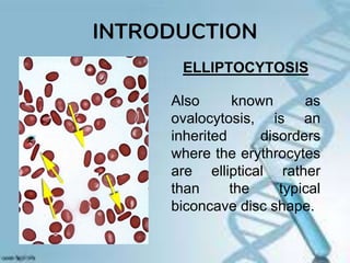 Seminario Eliptocitosis | PPTX