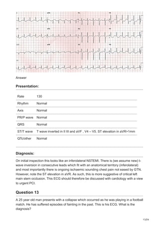 oxfordmedicaleducation.com-ECG EKG examples and quiz.pdf