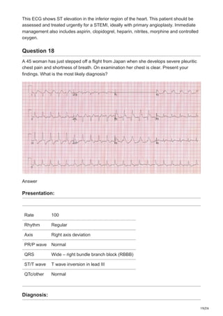 oxfordmedicaleducation.com-ECG EKG examples and quiz.pdf
