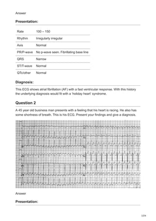 oxfordmedicaleducation.com-ECG EKG examples and quiz.pdf