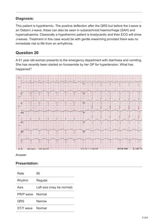 oxfordmedicaleducation.com-ECG EKG examples and quiz.pdf