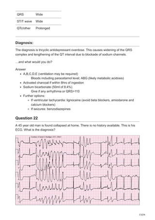 oxfordmedicaleducation.com-ECG EKG examples and quiz.pdf