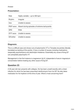 oxfordmedicaleducation.com-ECG EKG examples and quiz.pdf
