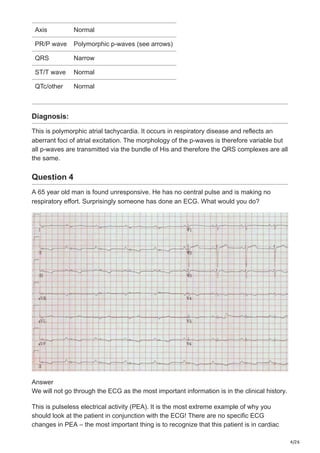 oxfordmedicaleducation.com-ECG EKG examples and quiz.pdf