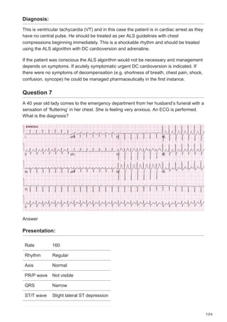 oxfordmedicaleducation.com-ECG EKG examples and quiz.pdf