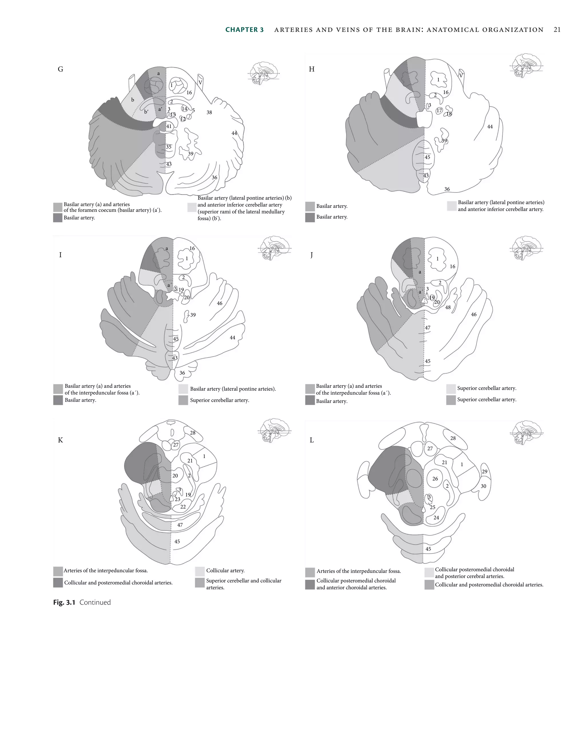 Oxford textbook of stroke and cerebrovascular disease ( PDFDrive ).pdf