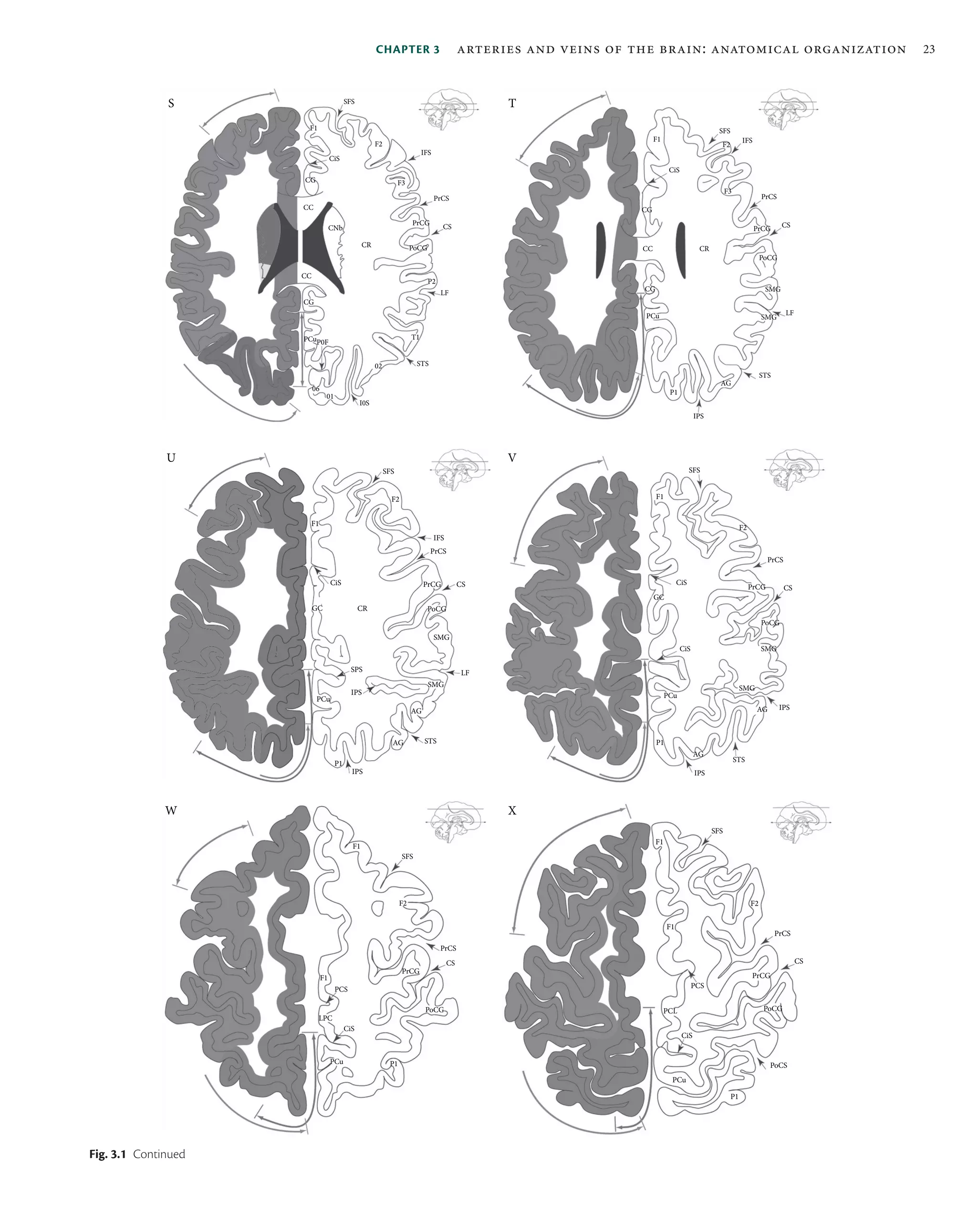 Oxford textbook of stroke and cerebrovascular disease ( PDFDrive ).pdf