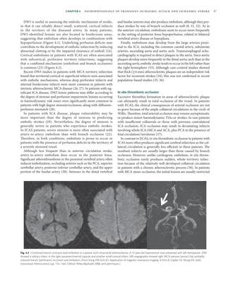Oxford textbook of stroke and cerebrovascular disease ( PDFDrive ).pdf