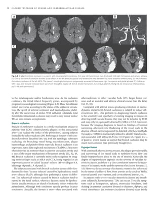 Oxford textbook of stroke and cerebrovascular disease ( PDFDrive ).pdf