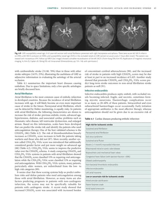 Oxford textbook of stroke and cerebrovascular disease ( PDFDrive ).pdf