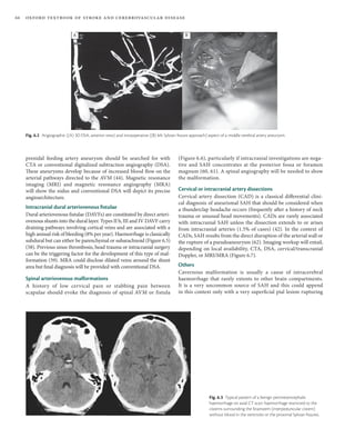Oxford textbook of stroke and cerebrovascular disease ( PDFDrive ).pdf