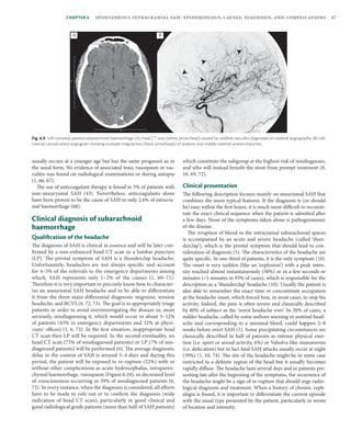 Oxford textbook of stroke and cerebrovascular disease ( PDFDrive ).pdf