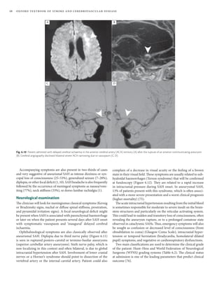 Oxford textbook of stroke and cerebrovascular disease ( PDFDrive ).pdf