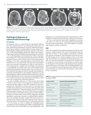 Oxford textbook of stroke and cerebrovascular disease ( PDFDrive ).pdf