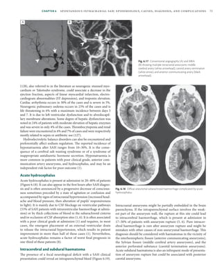 Oxford textbook of stroke and cerebrovascular disease ( PDFDrive ).pdf