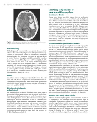Oxford textbook of stroke and cerebrovascular disease ( PDFDrive ).pdf