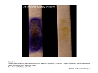 oxidase-test ppt for university BS MLT students | PPTX