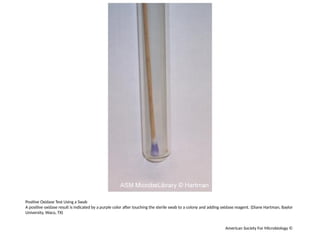 oxidase-test ppt for university BS MLT students | PPTX