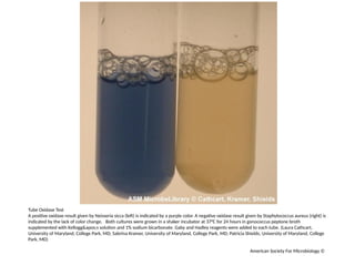 oxidase-test ppt for university BS MLT students | PPTX