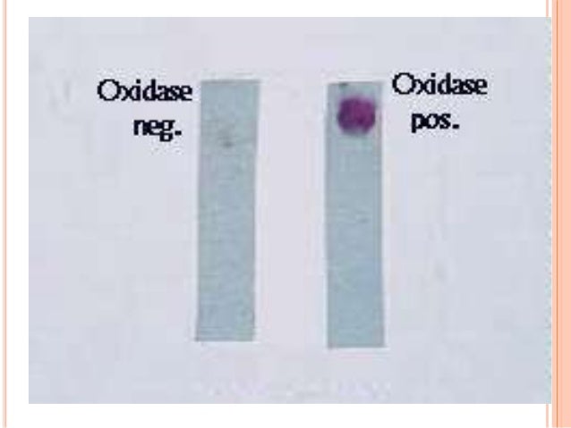 Biochemical reactions - Microbe identification
