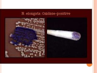 Oxidase test | PPTX