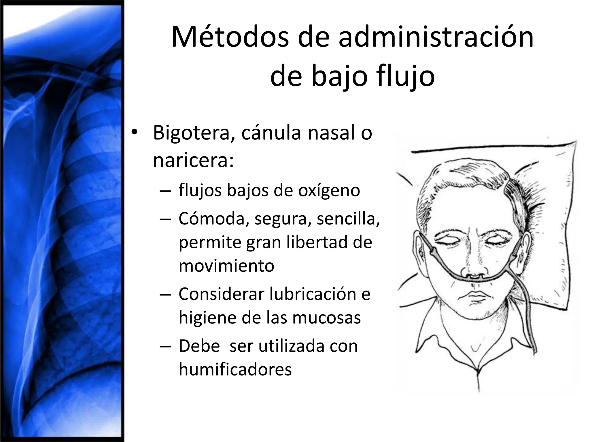 oxigenoterapia de bajo y alto flujo dispositivos | PPT