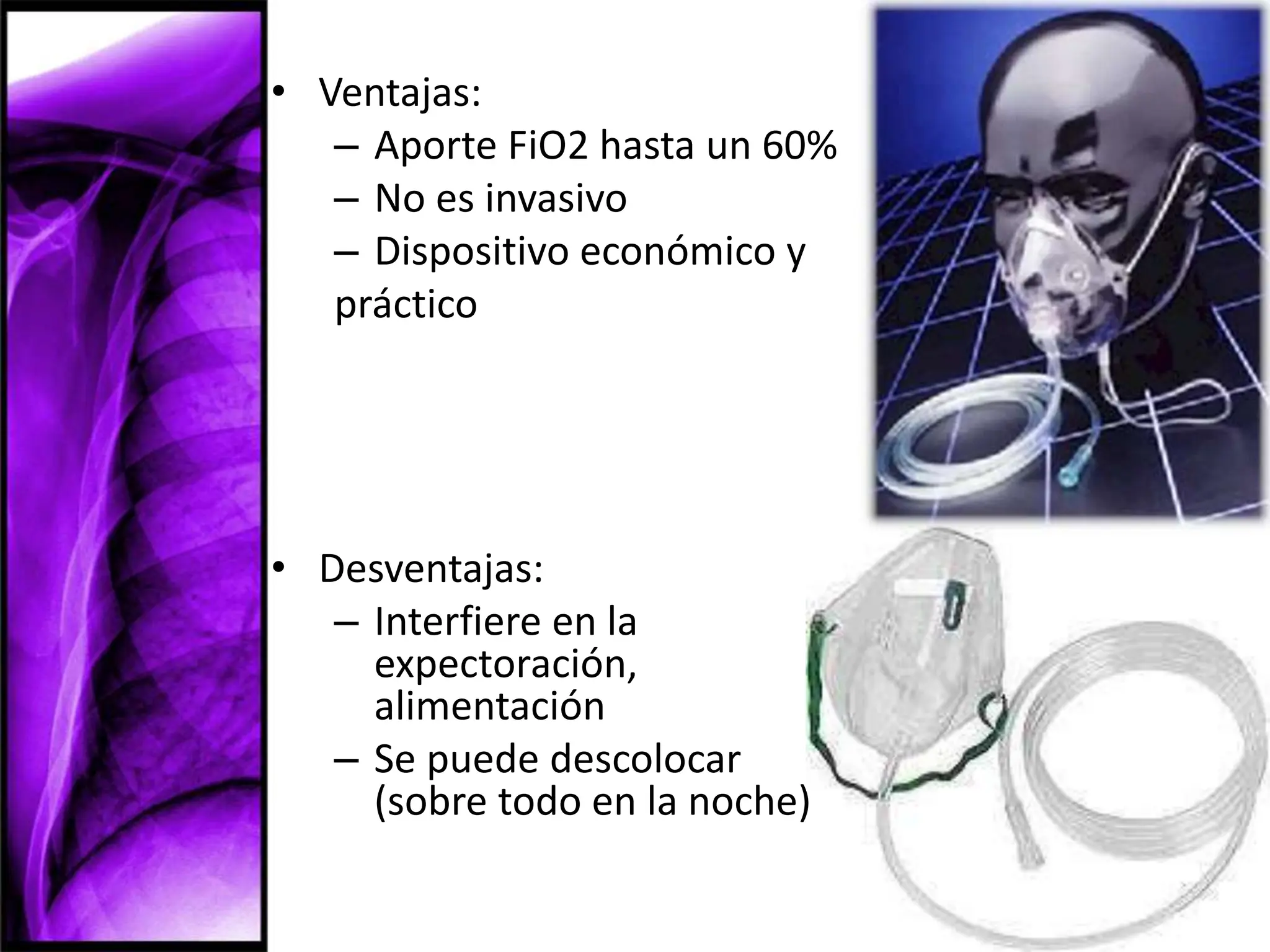 oxigenoterapia de bajo y alto flujo dispositivos | PPT
