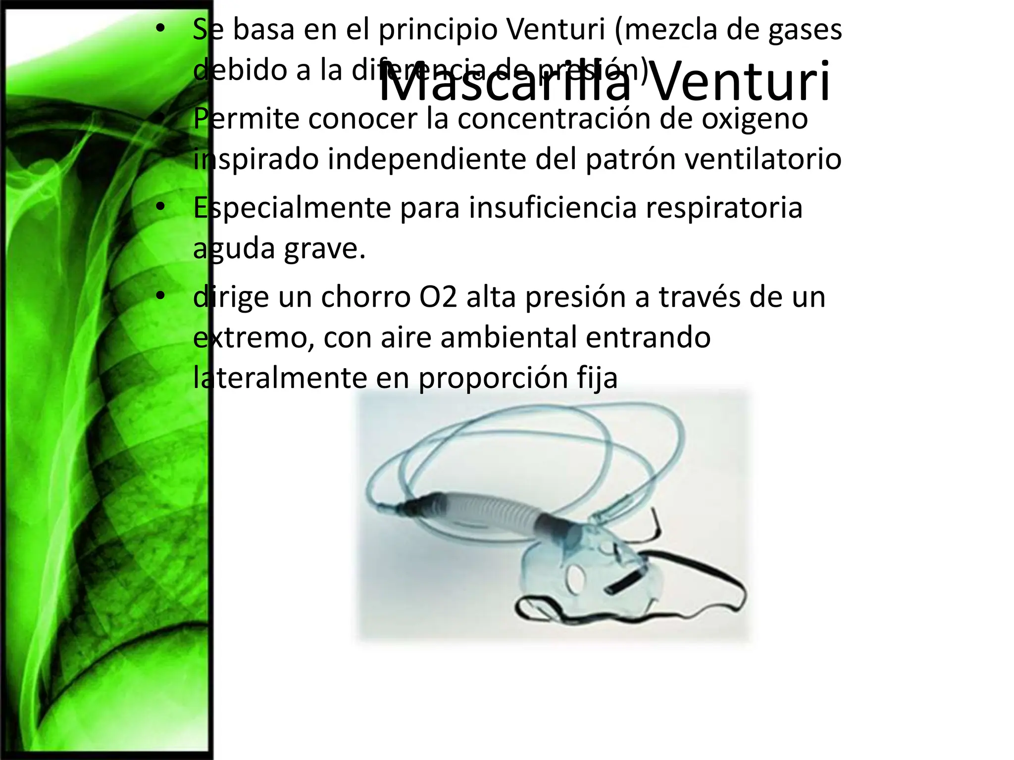 oxigenoterapia de bajo y alto flujo dispositivos | PPT