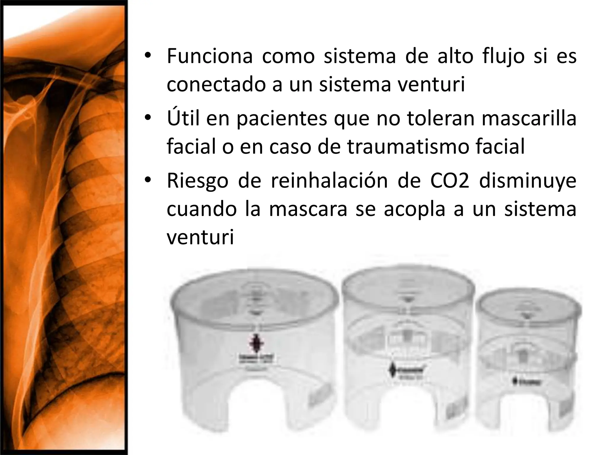 oxigenoterapia de bajo y alto flujo dispositivos | PPT