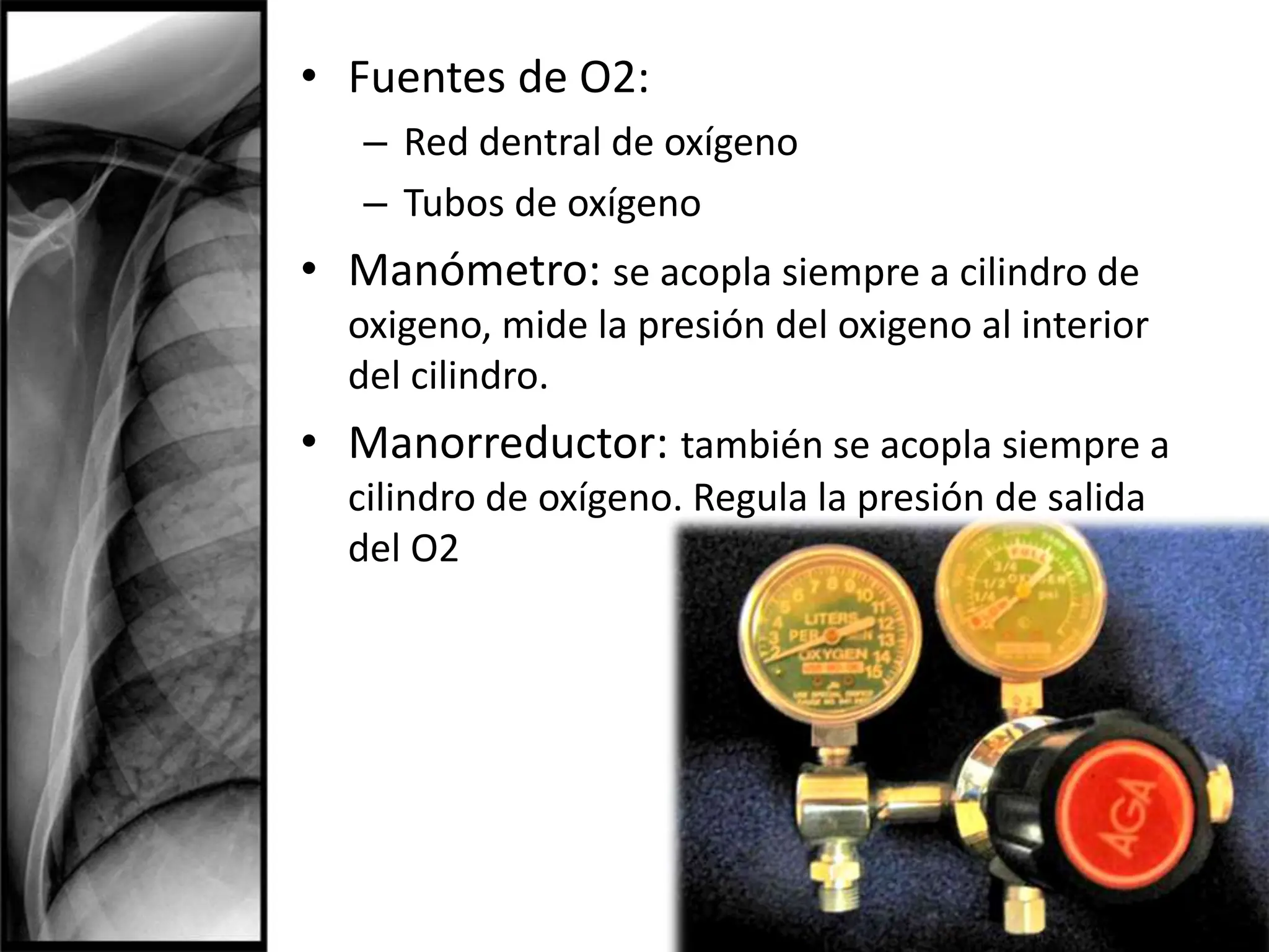 oxigenoterapia de bajo y alto flujo dispositivos | PPT