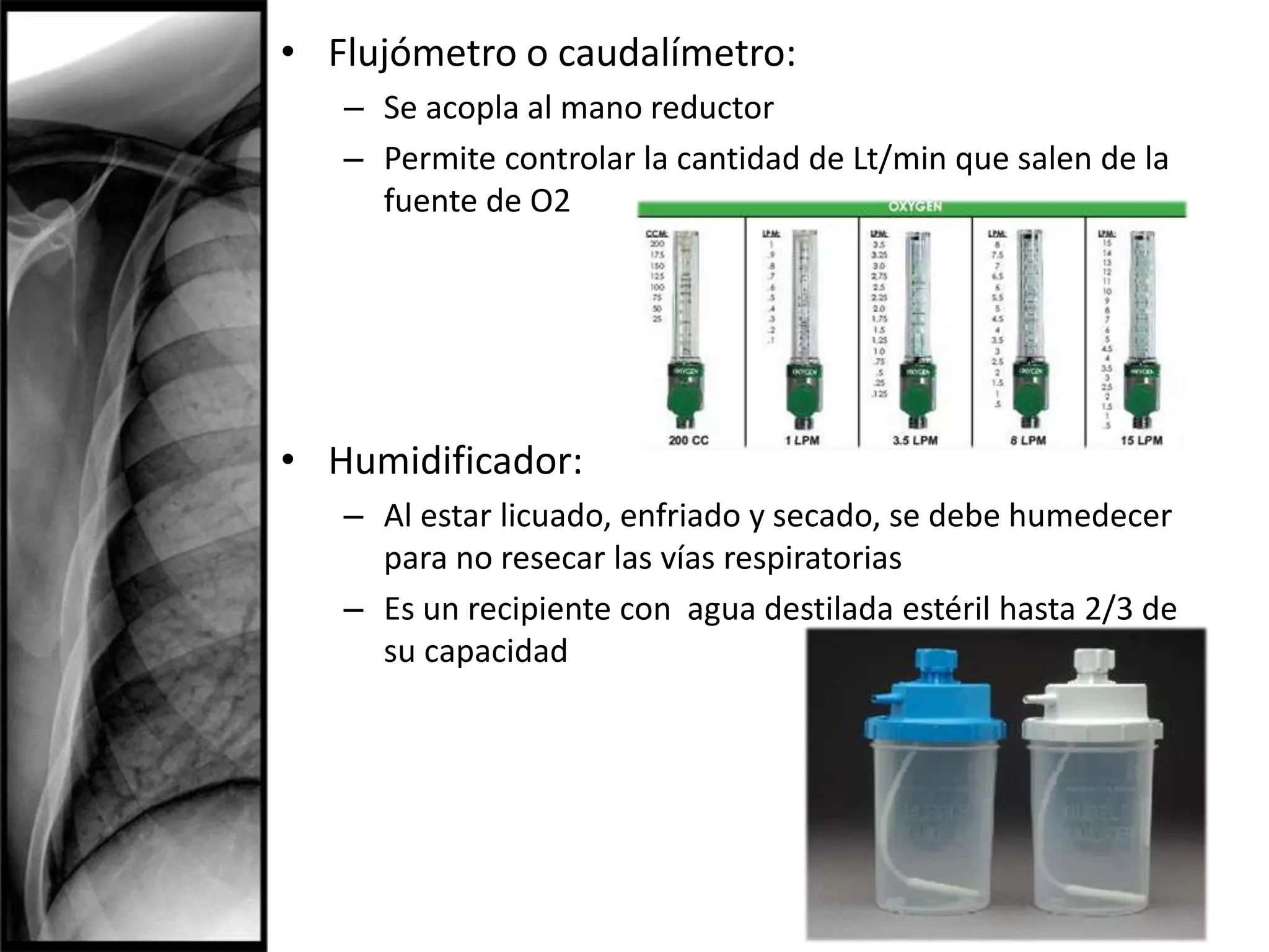 oxigenoterapia de bajo y alto flujo dispositivos | PPT