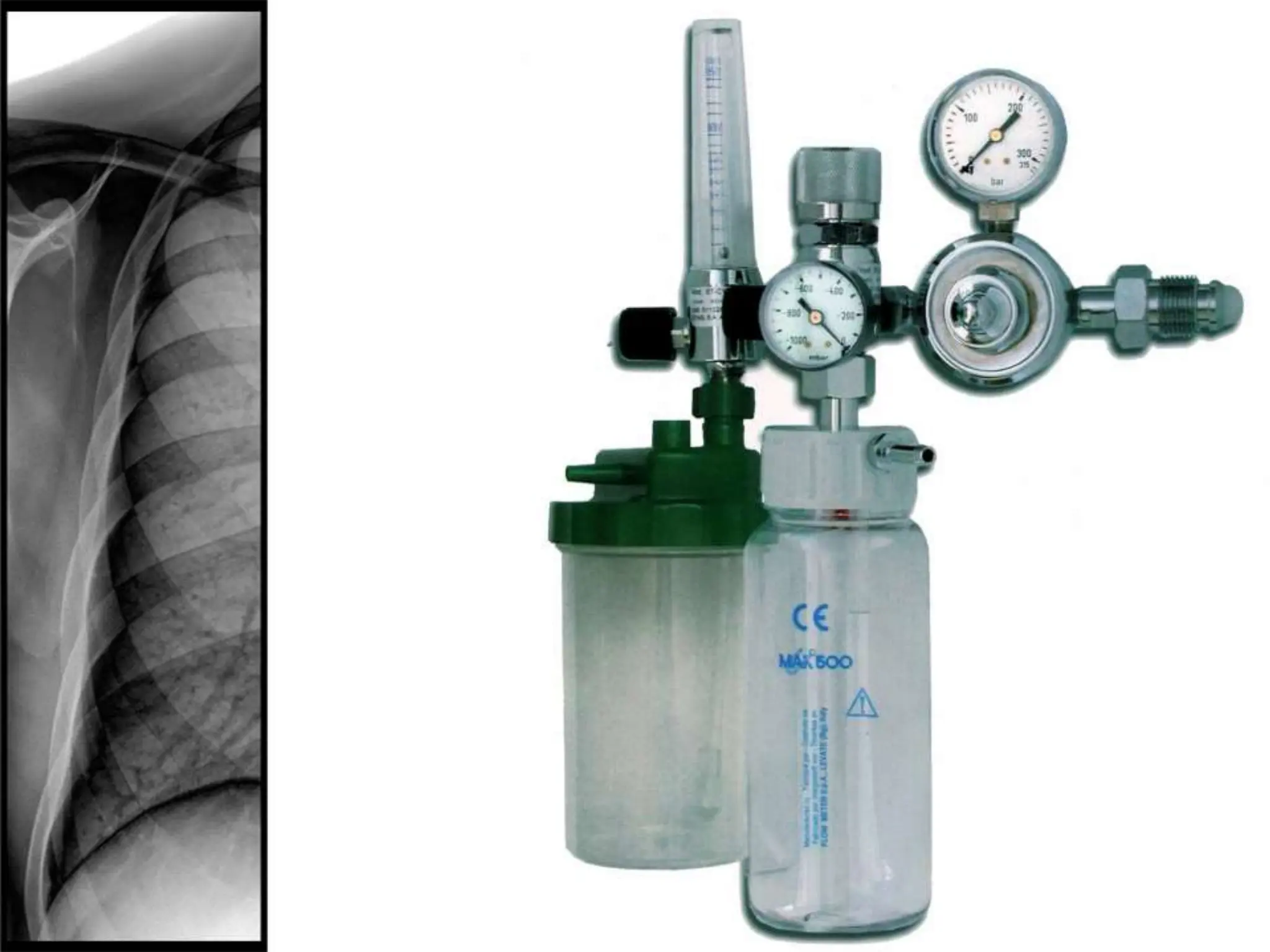 oxigenoterapia de bajo y alto flujo dispositivos | PPT