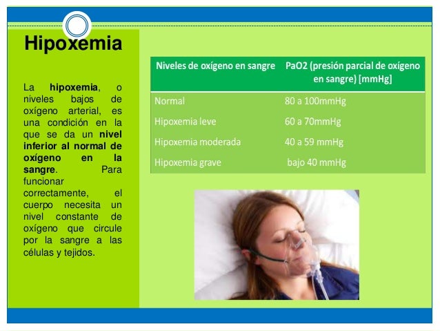 Oxigenoterapia UP Med
