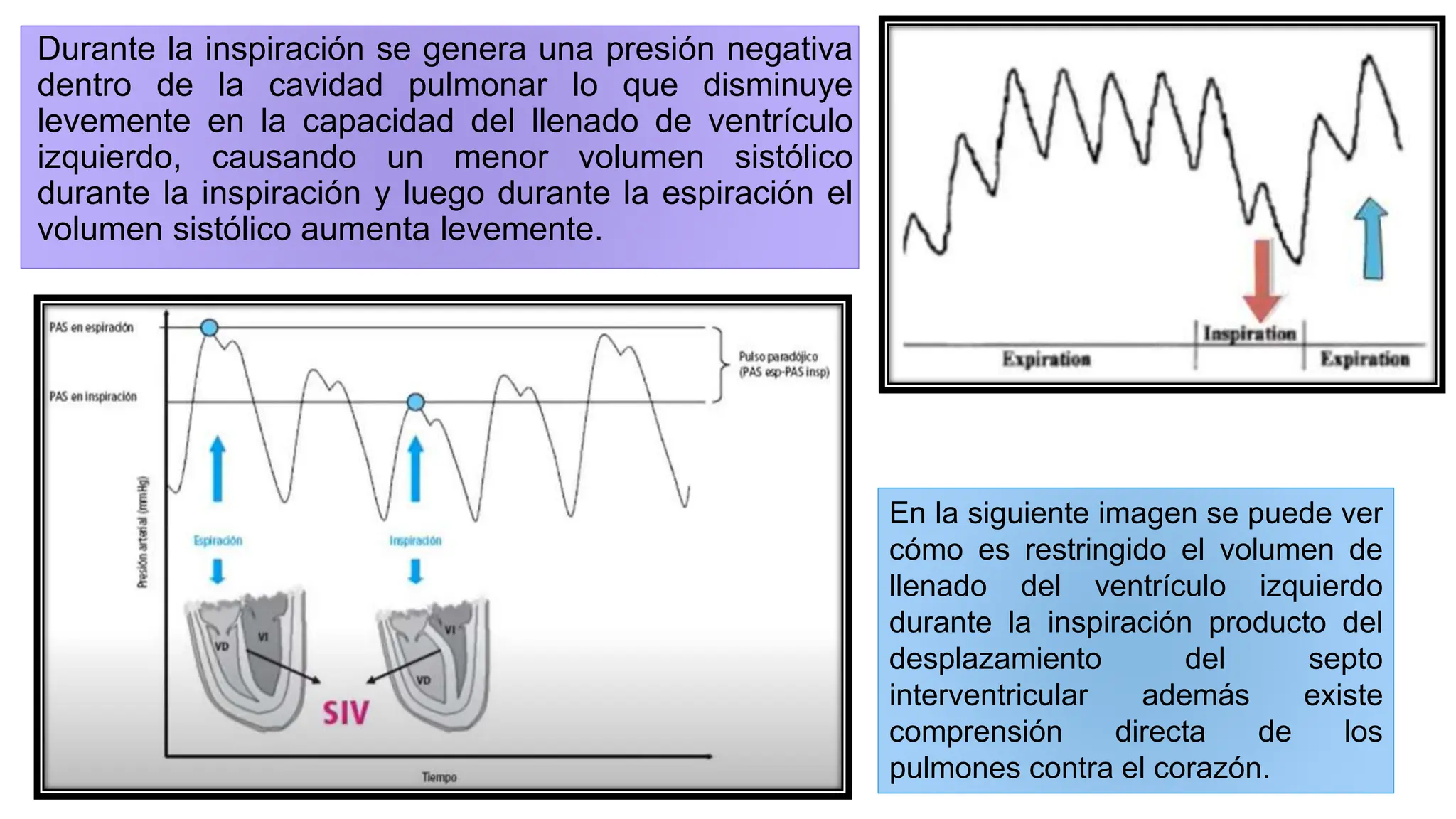 Oximetria Interpretación De La Curva Pletismográfica 18 Octu Pptx