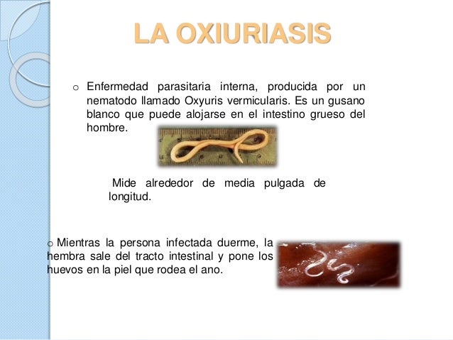 Oxiuriasis