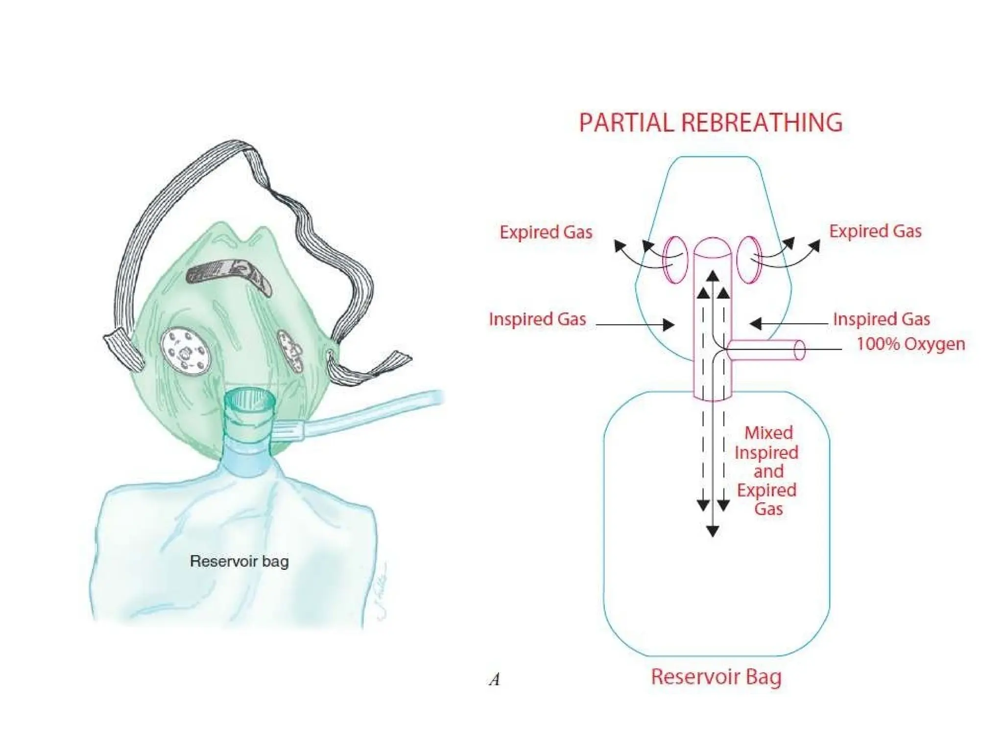 Oxygen-delivery-devices in hospitals and ICU.pptx