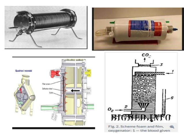 Oxygenators | PPTX | Lung and Respiratory Health | Diseases and Conditions