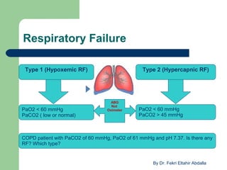 Oxygen delivery devices | PPT
