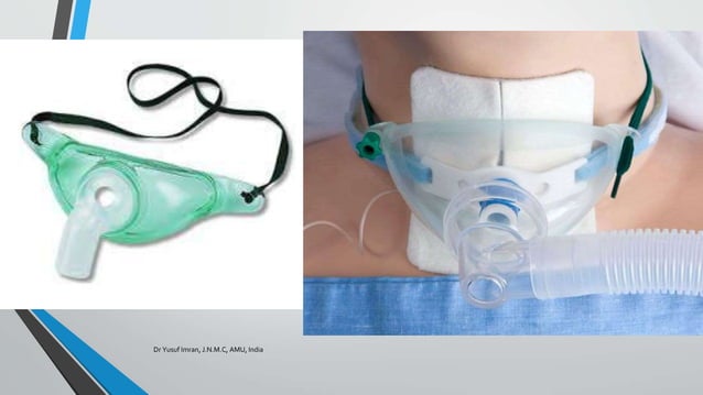 Oxygen delivery devices | PPTX | Lung and Respiratory Health | Diseases ...