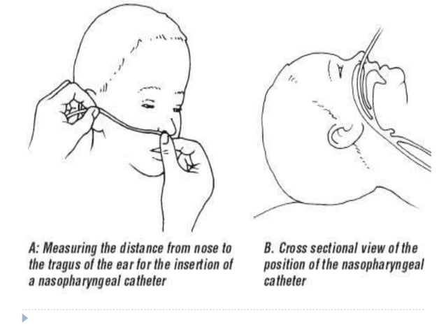 Oxygen delivery devices | PPTX | Ear, Nose and Throat Conditions ...