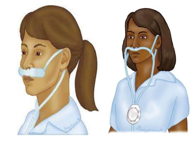 Oxygen delivery system | PPTX | Lung and Respiratory Health | Diseases ...