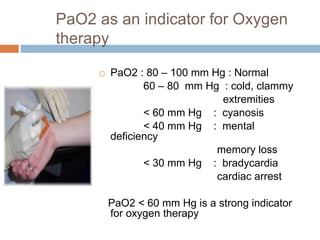 Oxygen therapy | PPT