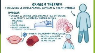 Oxygen therapy,hyperbaric oxygen and oxygen toxicity (2).pptx