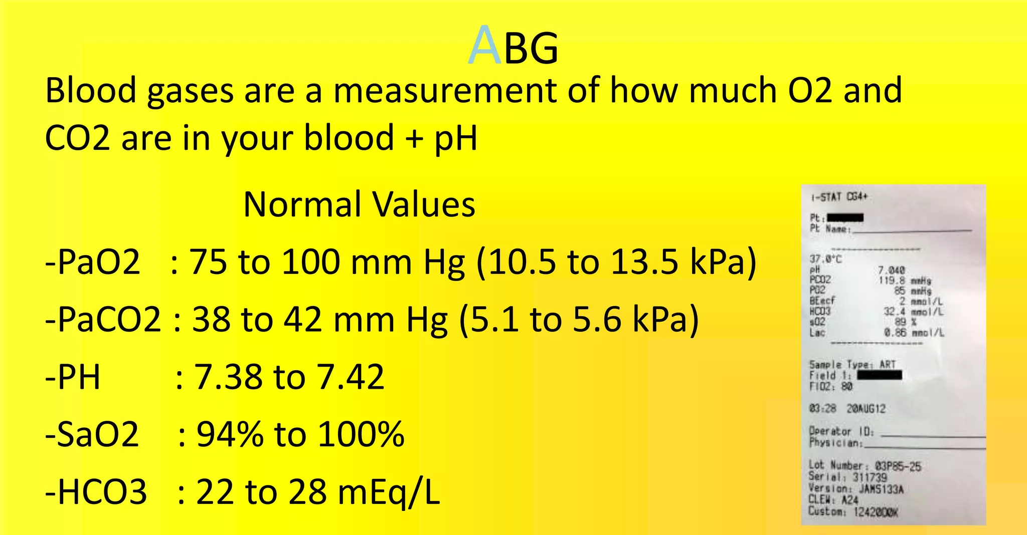 Oxygen therapy in pediatrics | PPTX