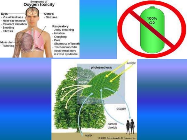 Oxygen toxicity | PPTX
